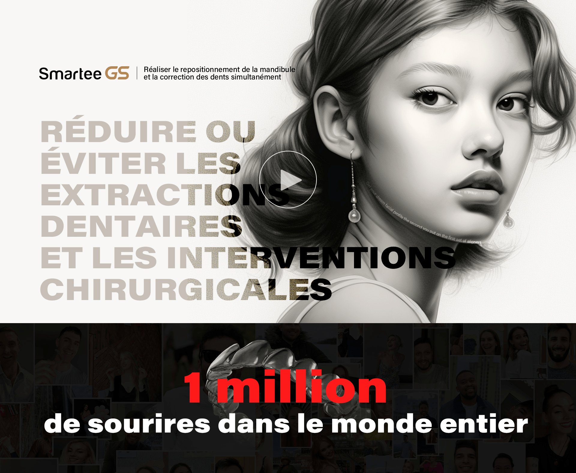 Smartee Clear Aligner