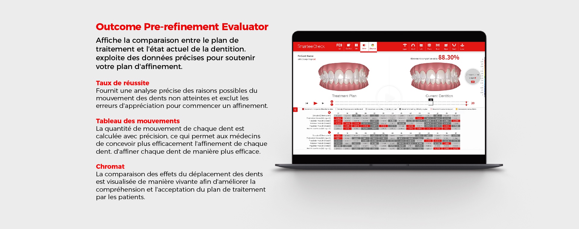 Smartee Clear Aligner