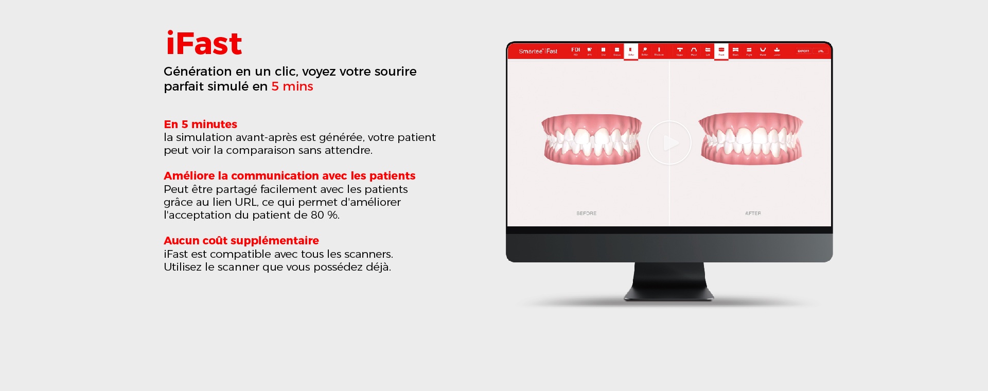 Smartee Clear Aligner