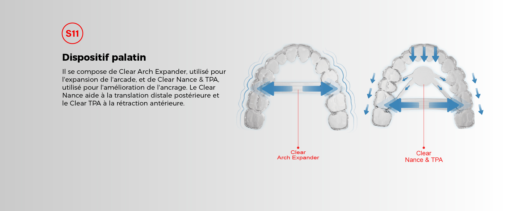 Smartee Clear Aligner
