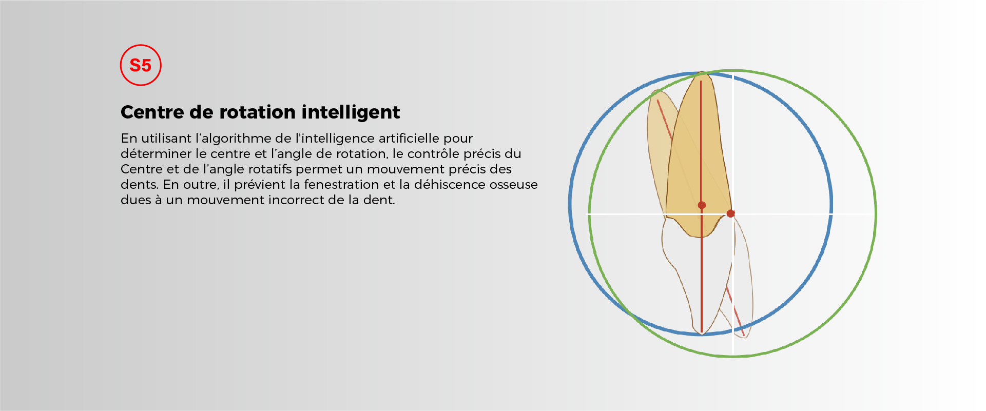 Smartee Clear Aligner