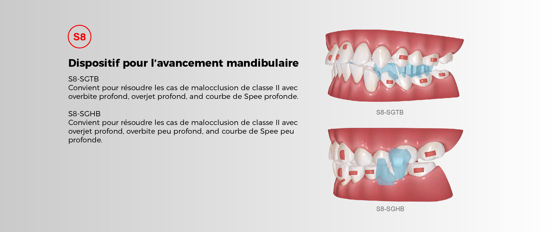 Smartee Clear Aligner