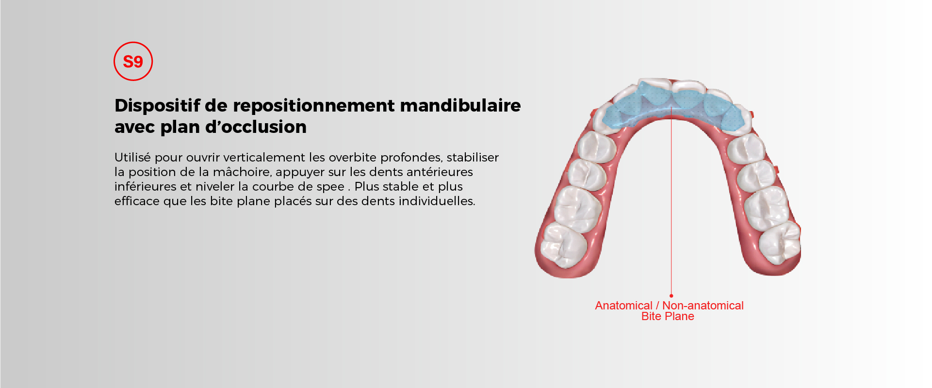 Smartee Clear Aligner