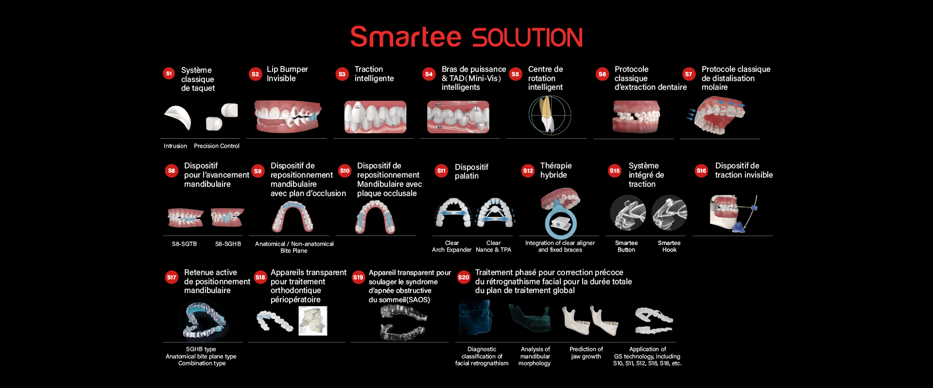 Smartee Clear Aligner